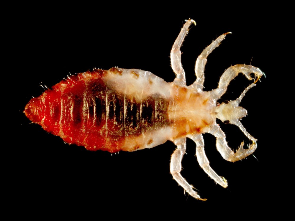 A Dangerous Bug Threatens Transplants. And Tells a Larger Story | The Tyee